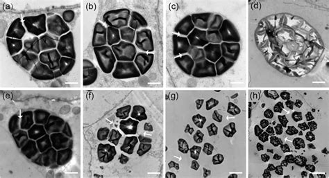 Electron Micrographs Depicting Amyloplast Development In Wt A D And