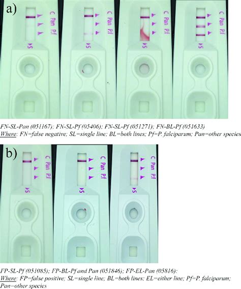 A Examples Of Negative Falsely Interpreted Test Lines Of Rdts At