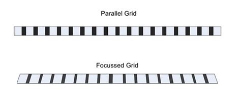 Anti Scatter Grids Part 2 Types Of Grid Wk6 Flashcards Quizlet Anti Scatter Grids Part 2 Types Of Grid Wk6 Flashcards Quizlet
