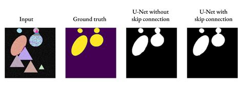 U Net 算法详解 Csdn博客