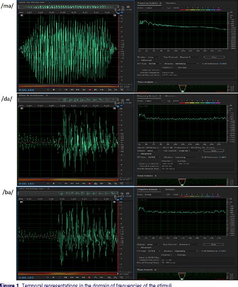 Figure 1 From Cortical Auditory Evoked Potentials Using The Speech Stimulus Ma Semantic Scholar