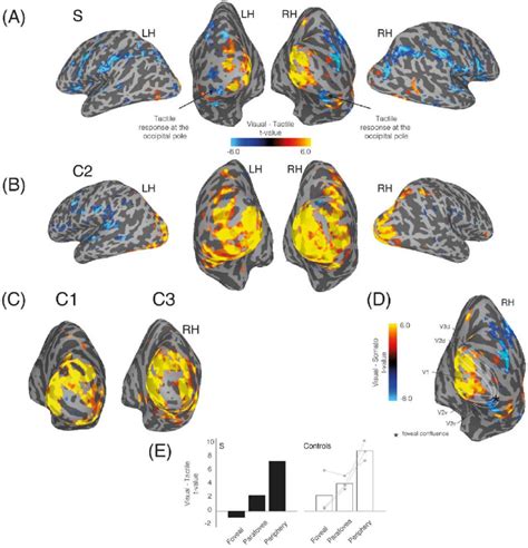 E Tactile Responses In Foveal Cortex Of S A Tactile And Visual Download Scientific Diagram