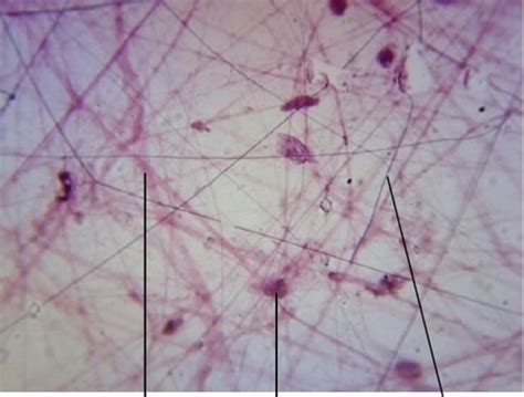 Lab Exam Connective Tissues Flashcards Quizlet