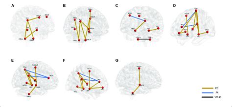 Aberrant Default Mode Network Underlying The Different Cognitive Download Scientific Diagram