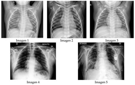 Symmetry Special Issue Symmetry And Metaheuristic Algorithms
