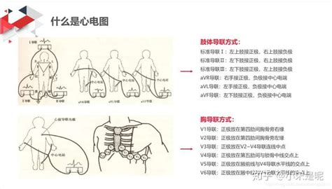 GitHub xiaosongshine ECG challenge baseline keras 深度应用 首届中国心电智能大赛