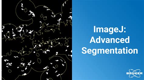 Advanced Segmentation Using Imagej
