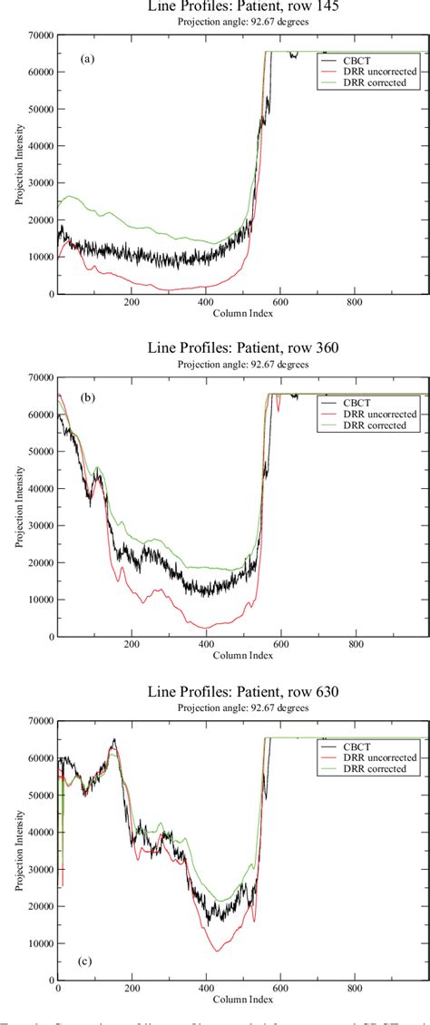 Figure 6 From A Digitally Reconstructed Radiograph Algorithm Calculated From First Principles