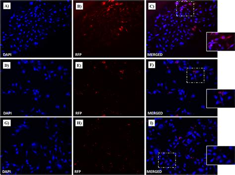 Doxorubicin Delivery In Triple Negative Breast Cancer Ijn