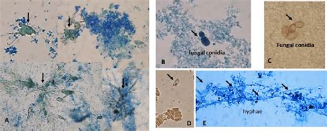 Observation Of Fungal Elements From The Life Cycle Of Filamentous Fungi