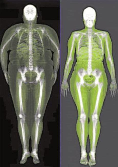 Bone Density Shin Imaging Center