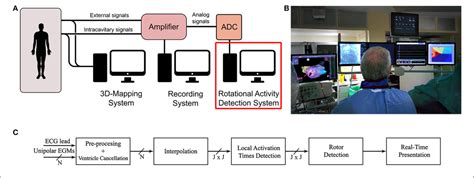 Figure 1 From Real Time Rotational Activity Detection In Atrial Fibrillation Semantic Scholar