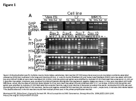 Figure 1 Nbsp Replicationspecific Multiplex Reverse Transcriptasepolymerase Chain