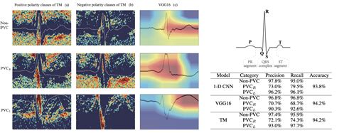 [r] Tsetlin Machine In Medical Research Striking Differences Between Tsetlin Machine