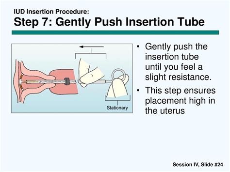 Procedure On Copper T Insertion Pdf Uterus Vagina 54 Off