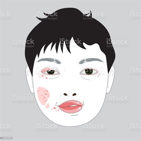 Allergy Stock Illustration Download Image Now Adult Adults Only