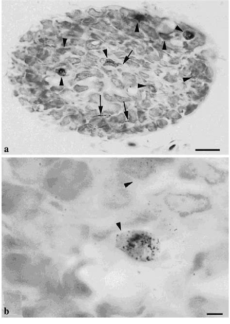 Light Microphotographs From Amg Stained Sections 48 H After Sodium