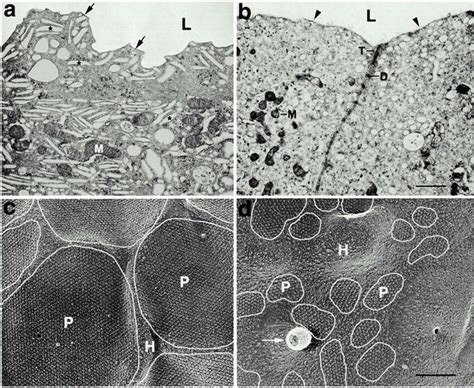 Upiii Negative Urothelium Lacked The Uroplakin Containing Fusiform