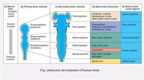 Ncct And Cect Brain And Orbit Pptx