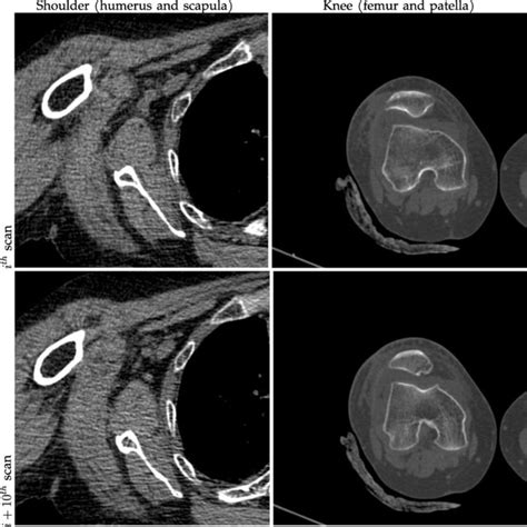 Annotation Process Original Ct Scan Left First Row Annotated Ct
