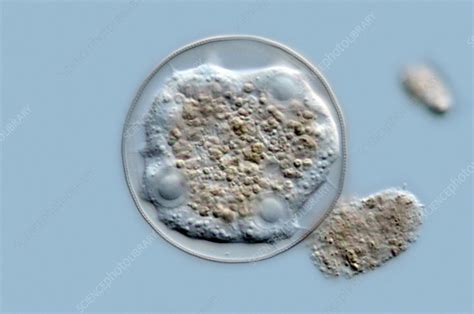 Shelled Amoeba Light Micrograph Stock Image C026 1092 Science Photo Library