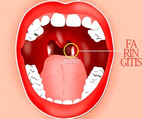 20 Síntomas Que Pueden Indicar Que Tu Hígado Está Dañado Salud