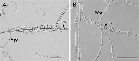 Mycoparasitic Interactions Between A Pythium Oligandrum Po And P Download Scientific
