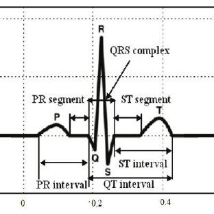 PDF ECG Beat Classification Using Wavelets And SVM