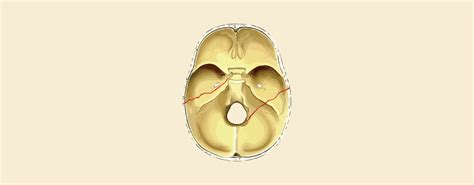 Longitudinal Fracture Epos™