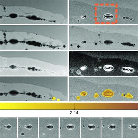 Gradient Recalled Echo Gre And Flaps Images Obtained Following Download Scientific Diagram