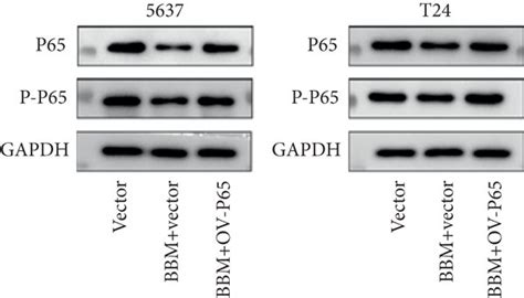 Berbamine Inhibited The Nf κb Pathway In Bladder Cancer Cell Lines A