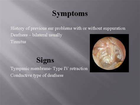 Otitis Media With Effusion Treatment At Edith Erdman Blog