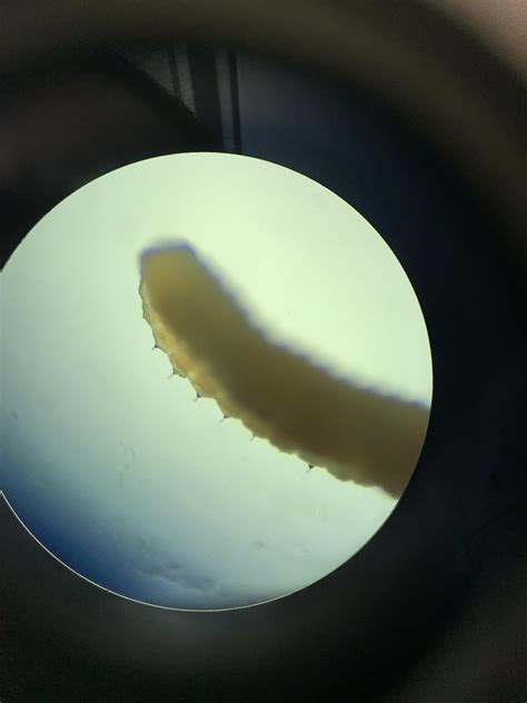 What Is This Worm Hookworm Pg 215 Rparasites