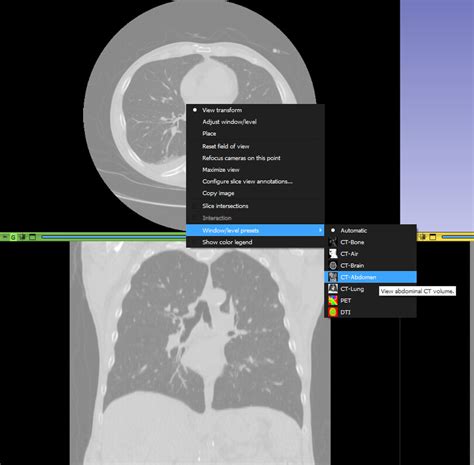 New Extension Scripteditor A Simple Programming Editor Announcements 3d Slicer Community
