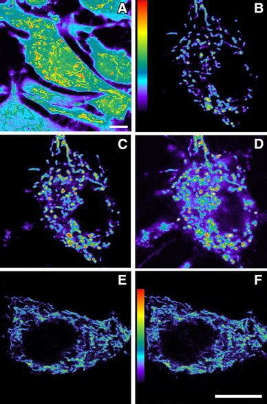 Fluorescence Imaging Of Reactive Oxygen Species Generation In Cultured