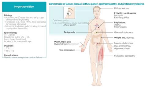 Hyperthyroidism Flashcards Quizlet