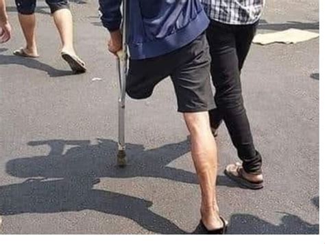 ကိုဗစ်ကာလနောက်ပိုင်းမှစတင်ကာ မသန်စွမ်းသူများ အသက်မွေးဝမ်းကျောင်း အလုပ်လုပ်ကိုင်ရာတွင် အခက်အခဲမ