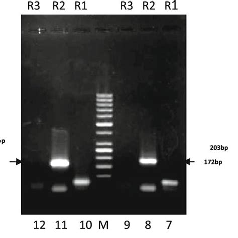 Pdf Rapid And Accurate Identification Of Mycobacterium Tuberculosis Complex And Common Non