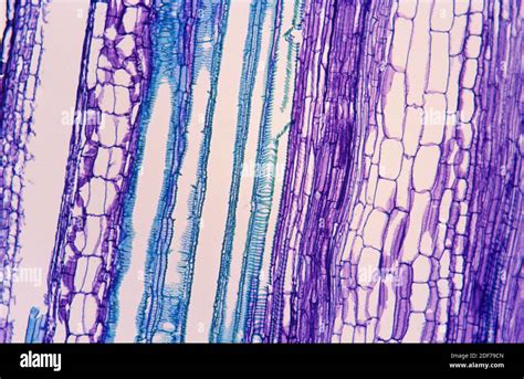 Xylem Cell Under Microscope