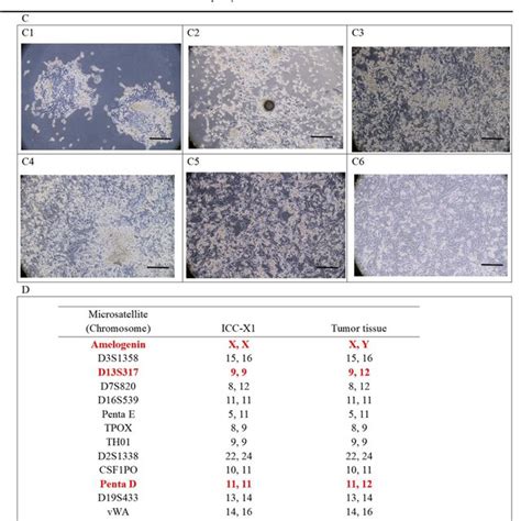 Clinical Data Morphology Short Tandem Repeat Str Detection And Download Scientific Diagram