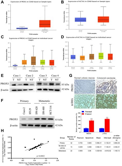 Prox1 Interaction With α Sma Rich Cancer Associated Fibroblasts Facilitates Colorectal Cancer