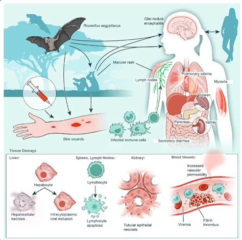 Marburg Virus Disease Reported In Ghana