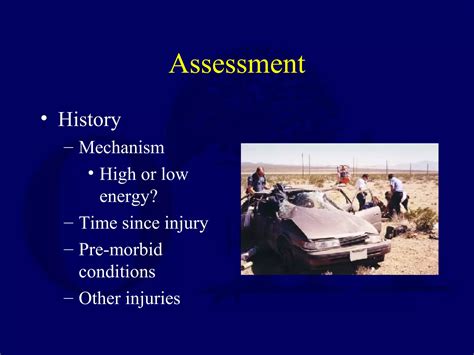 G13 Mangled Extremity Ppt