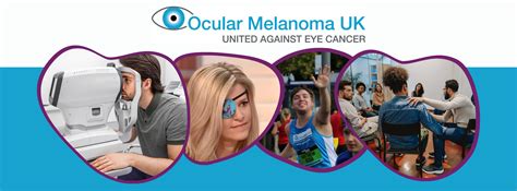 Ocular Melanoma Uk