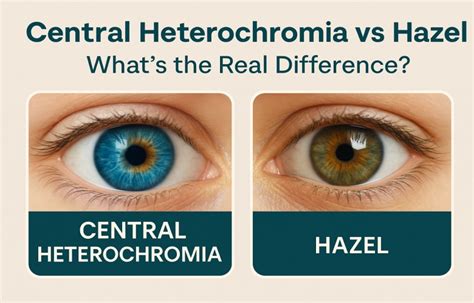 Central Heterochromia Vs Hazel Whats The Real Difference