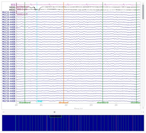 Repairing Artifacts With Regression — Mne 103 Documentation