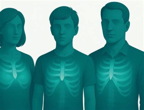 4 Effective Exercises For Pectus Excavatum