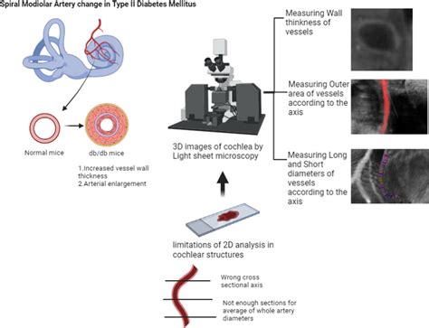 Three‐dimensional Analysis Of The Spiral Modiolar Artery Sma In The
