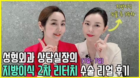 지방이식후기 성형외과 상담실장의 지방이식 2차수술 리얼 후기상담실장성형수술수술후데일리영상성형브이로그지방이식후기 Youtube