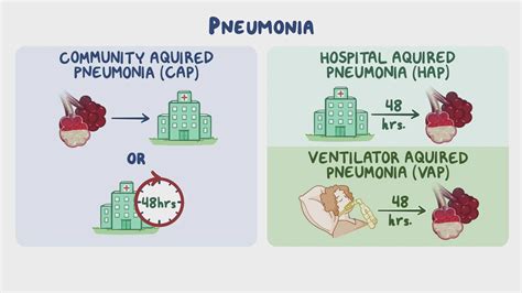 Hospital Acquired Pneumonia Hap Treatment What Is The Most Common Cause Of Hap Science Online